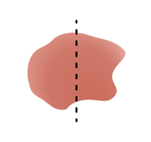 Melanoom symptomen | herkennen en behandelen